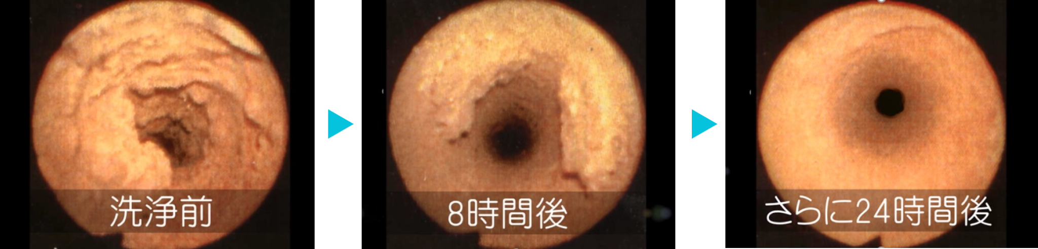 Low pressure combined water jet washer "NR Series" | Products-MATSUI